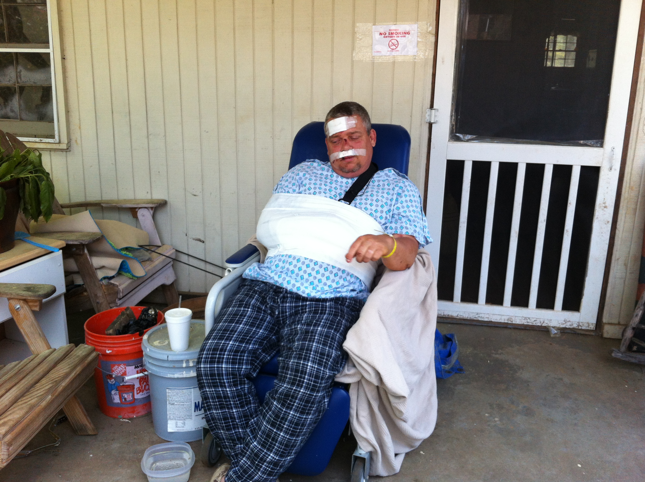 Man falls down well, after falling from porch | 11alive.com