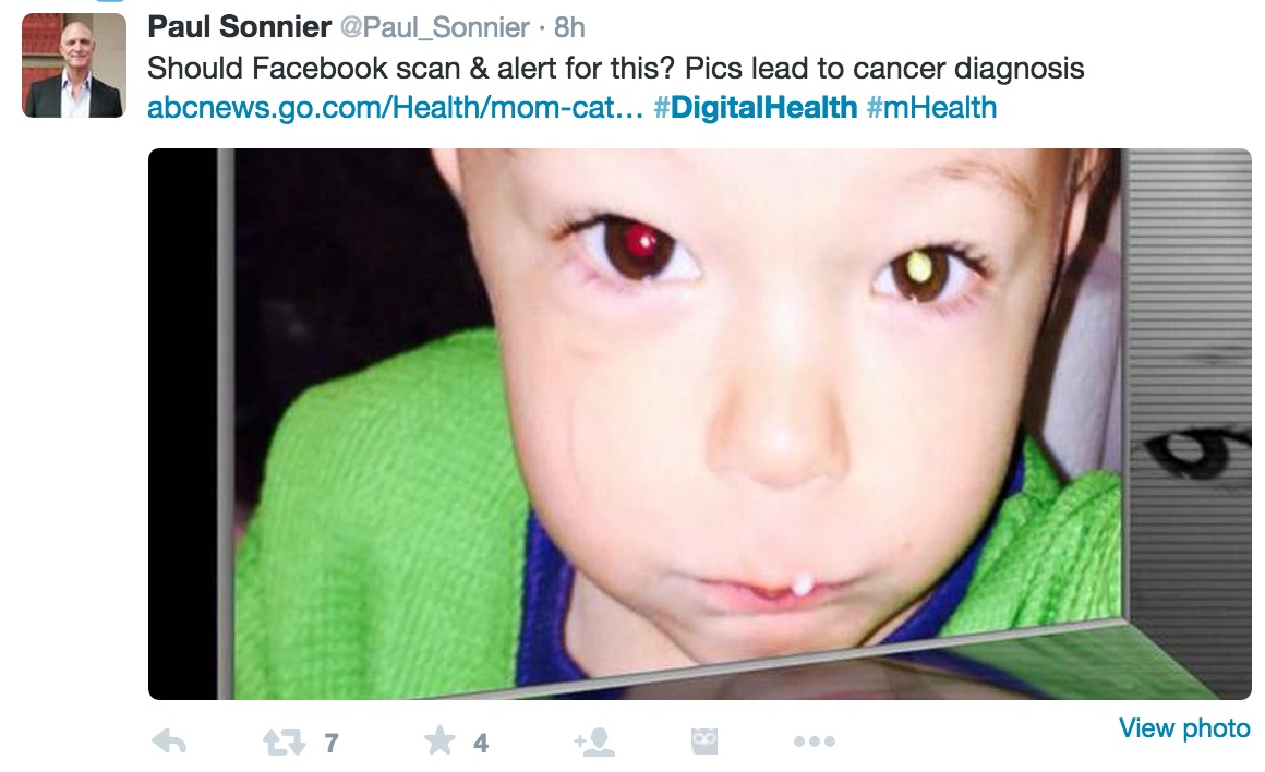 Mom catches toddler's eye cancer by snapping a photo | 11alive.com